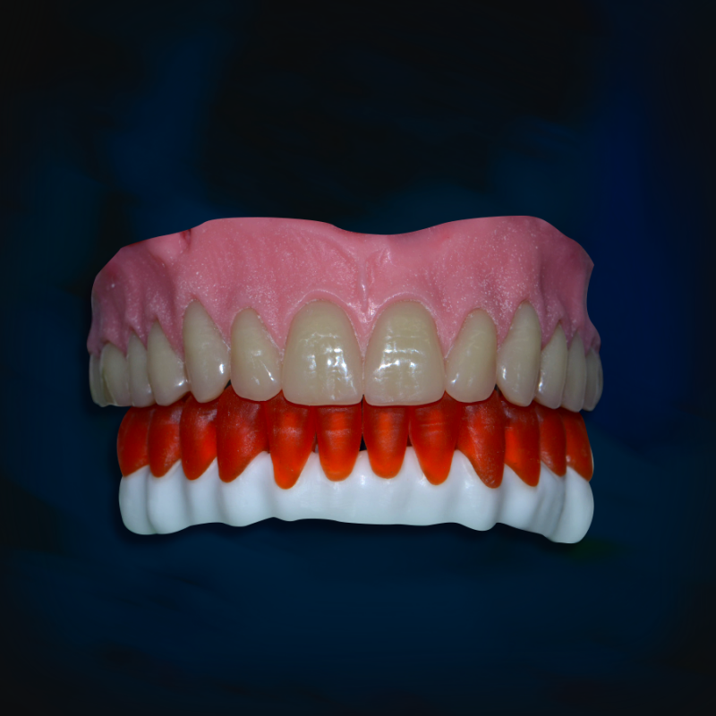 Prótese Total - TGS Prótese Dentária